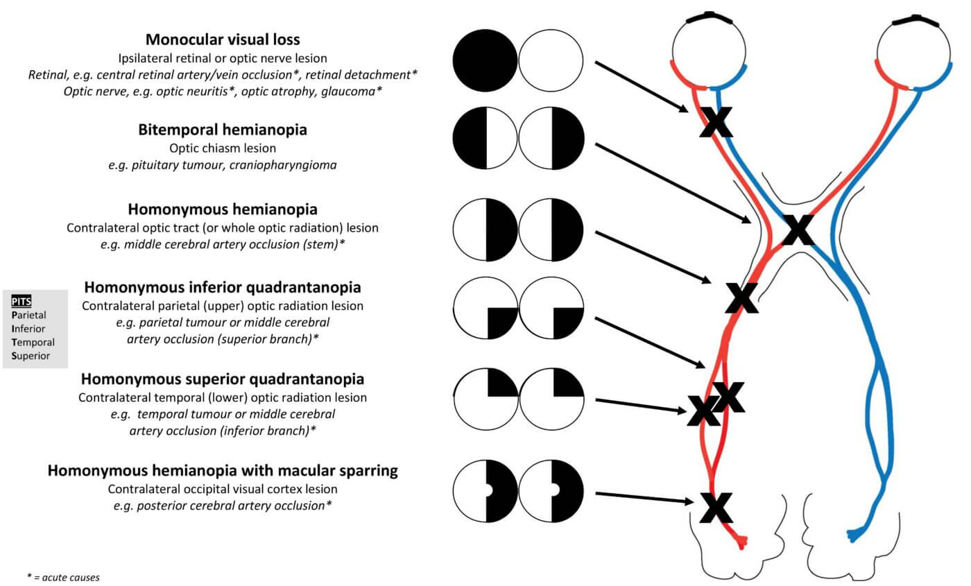 Visual system examination | OSCEstop | OSCE Learning